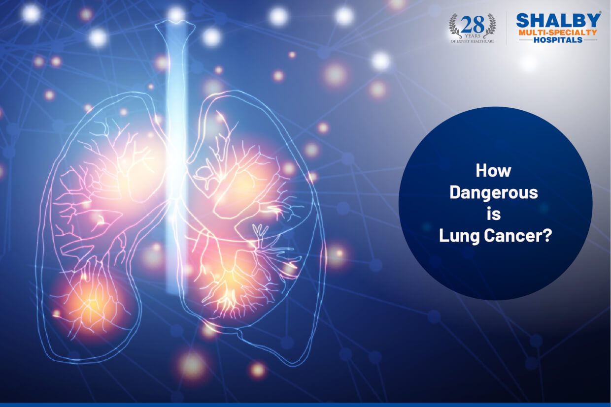 How Dangerous is Lung Cancer? - Oncologist in Ahmedabad