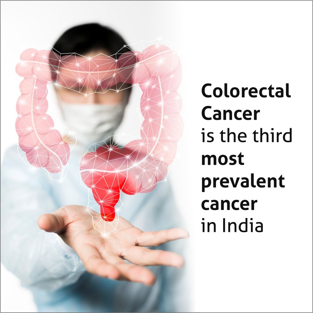 Understanding Colorectal Cancer: Causes & Early Detection