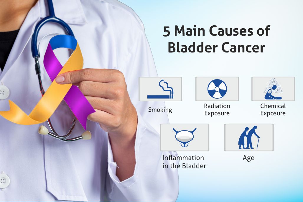 Confronting the Challenges of Bladder Cancer: Awareness, Prevention ...