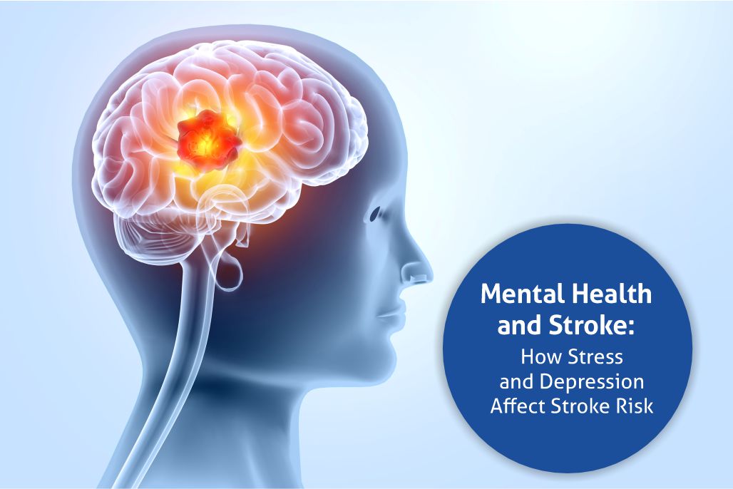 Mental Health and Stroke: How Stress and Depression Affect Stroke Risk ...