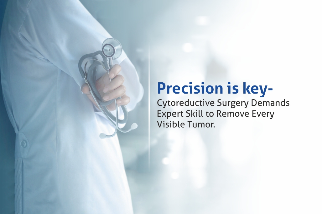 Cytoreductive Surgery For Advanced Ovarian Cancer