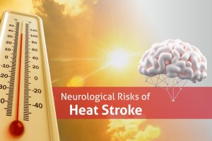 Emergency Response: What to Do When Someone Has Heat Stroke - Shalby ...