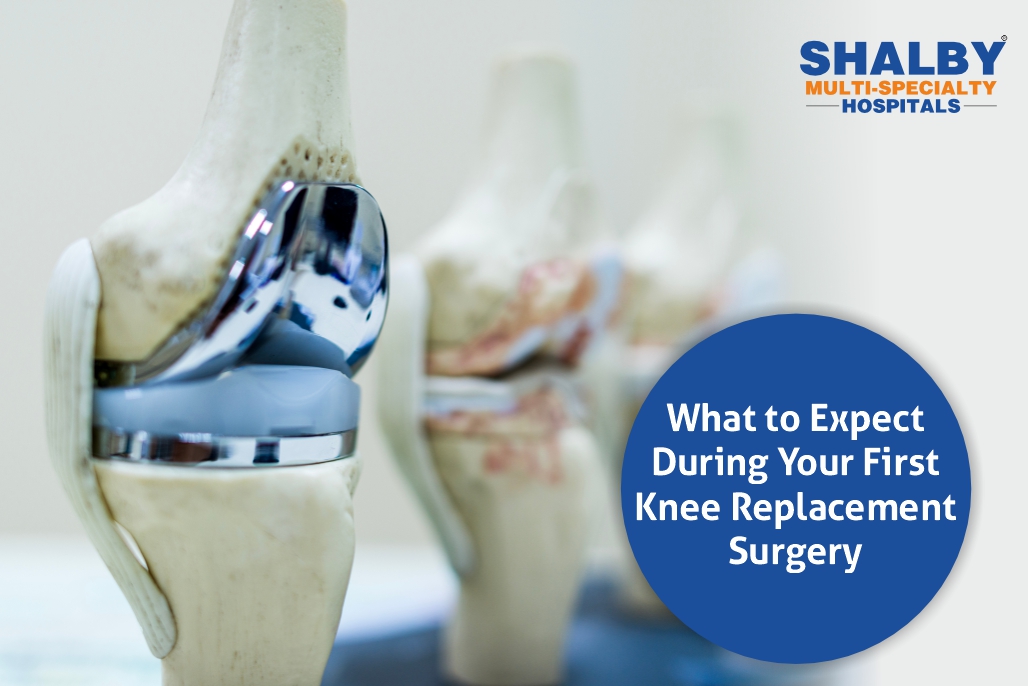 What to Expect During Your First Knee Replacement Surgery - Shalby Hospital
