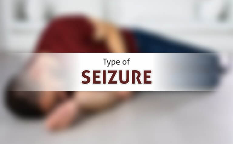 Understanding Epilepsy: Causes, Symptoms & Treatment - Shalby Hospital